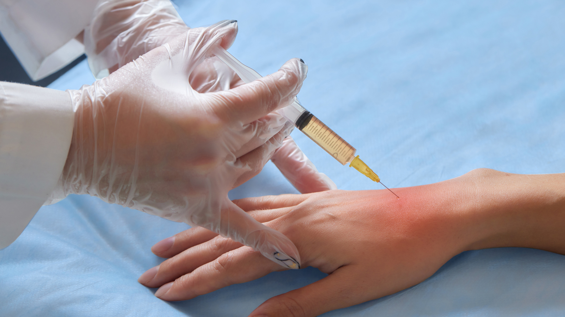 Hand and Wrist Joint Inflammation | Does 3D PEMF Help?